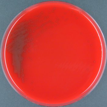 Streptococcus pneumoniae