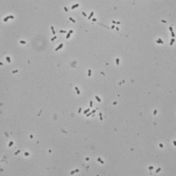 Streptococcus pneumoniae