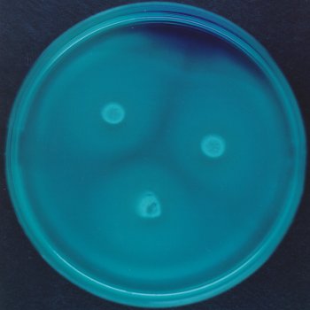 Modified Semisolid Rappaport Vassiliadis
